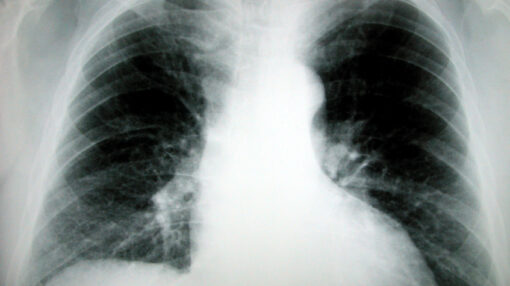 15 uses for helium you never knew existed